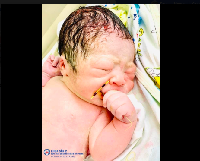 Failed contraception: newborn baby clasps IUD after being born [a viral ...